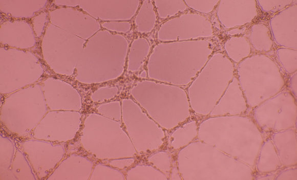 What is Angiogenesis? | 株式会社ハイマート(Heimat)